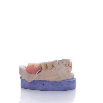 Removable Prosthodontics – Evoq DDS